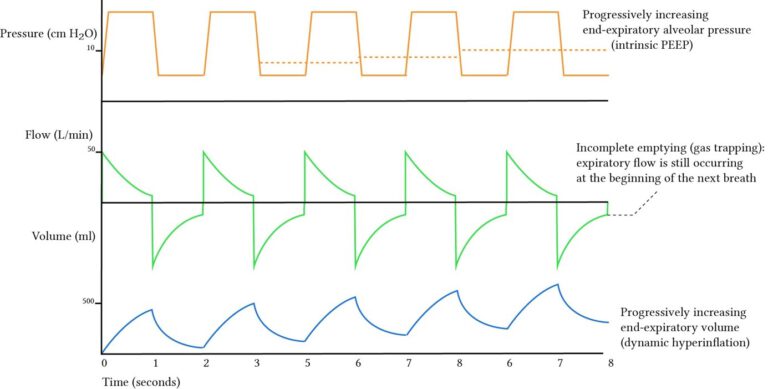 Hoffentlich kein Kampf um jeden Atemzug! Grundlagen von nicht-invasiver ...